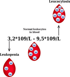 White blood cell count leukopenia leukocytosis Vector Image