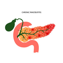 Pancreas Vector Images (over 6,200)