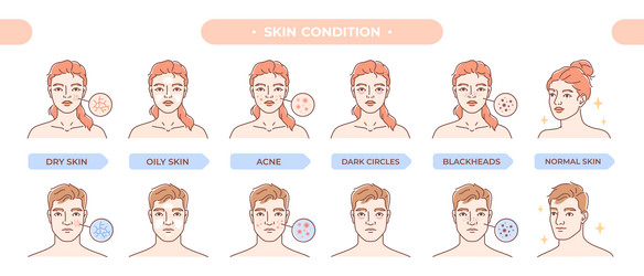 Skin types man set Royalty Free Vector Image - VectorStock