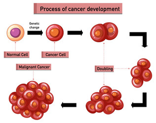 Process of cancer cell development Royalty Free Vector Image