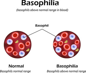 Basophils above the normal range in blood Vector Image
