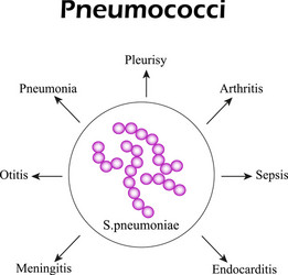Pneumococcal Vector Images (over 180)
