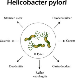 Helicobacter pylori symptoms of infection Vector Image