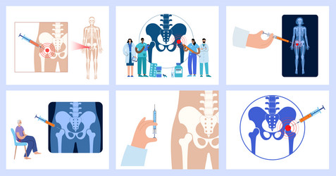 Hip joint injection Royalty Free Vector Image - VectorStock