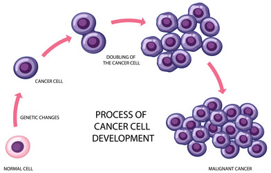 Process of cancer cell development Royalty Free Vector Image