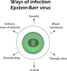 Epstein-barr virus diseases caused Royalty Free Vector Image