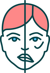 Facial Palsy Vector Images (15)