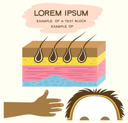 Skin Cartoon Layers Vector Images (over 160)