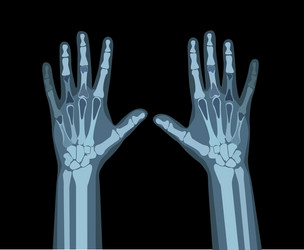 Hand Xray Vector Images (over 2,200)