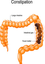Anatomy of the large intestine colon Royalty Free Vector