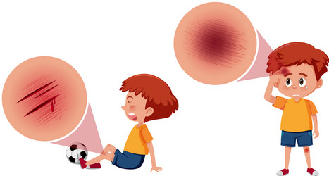 Isolated hand open wound Royalty Free Vector Image