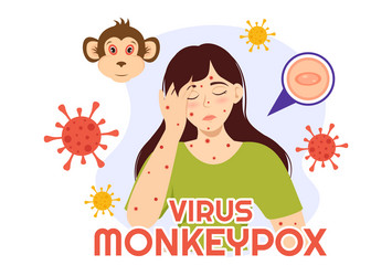 Monkey pox outbreak of virus symptoms in humans Vector Image