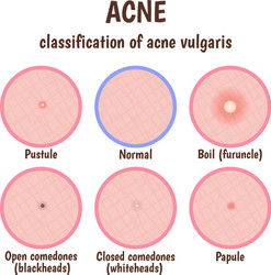 Bumps in the Skin Vector Images (over 190)