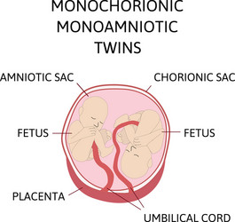 Anatomy abdomen with twins twin types Royalty Free Vector