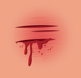 Skin Wound Vector Images (over 2,300)