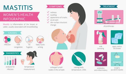 Mastitis breastfeed medical infographic Royalty Free Vector