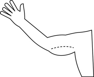 Plastic surgery flabby arm correction icon Vector Image