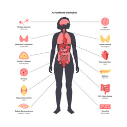 Autoimmune disease infographic Royalty Free Vector Image