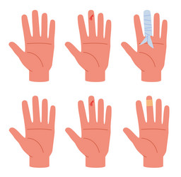 Hand with bleeding cut palm wound injury icon Vector Image