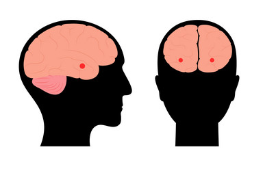 Amygdala Vector Images (over 180)