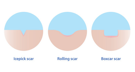 Scars Skin Vector Images (over 1,800)