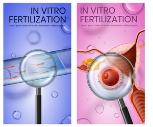 Uterus with implanted embryo test tube sperm Vector Image
