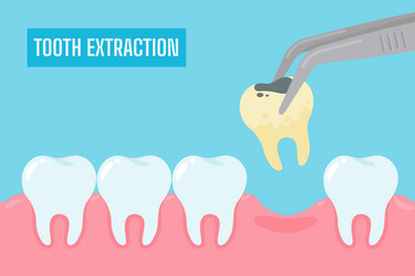 Tooth Extraction Cartoon Vector Images (over 300)