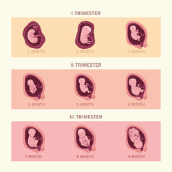 Fetal Presentation Vector Images (38)