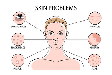 Acne Infographic Vector Images (over 710)
