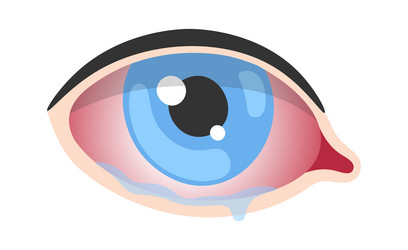 Eye Infection Vector Images (over 6,100)