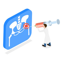 Hip arthroplasty joint before and after surger Vector Image