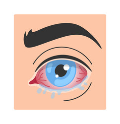 Eye Infection Vector Images (over 6,100)