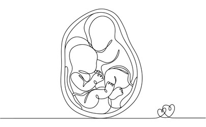 Twins in Womb Vector Images (40)