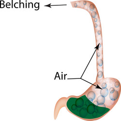 Heartburn air in the stomach structure Royalty Free Vector