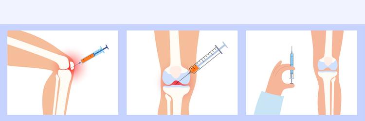 Knee injection concept Royalty Free Vector Image