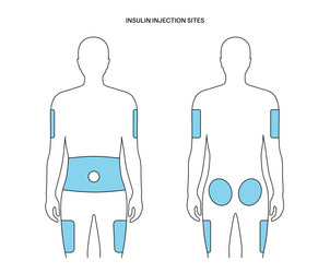 Insulin Injection Sites Vector Images (40)
