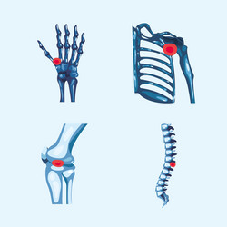 Rheumatology icon set Royalty Free Vector Image