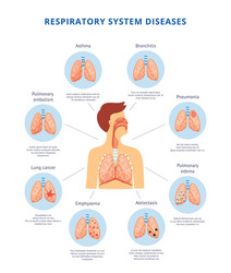 Anatomical medical scheme respiratory system Vector Image