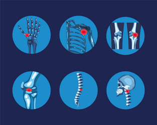 Rheumatology icon set Royalty Free Vector Image