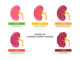 Ckd Vector Images (46)