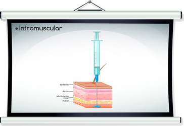 Intramuscular injection with explanation Vector Image