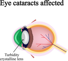 Affected Vector Images (over 37,000)