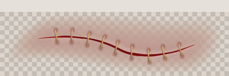 Surgical Wound Vector Images (over 500)