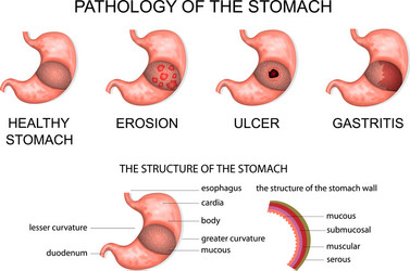 Pathology Vector Images (over 12,000)