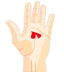 Hand Wound Palm Vector Images (over 250)