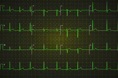 Ekg Green Electrocardiogram Vector Images (over 460)