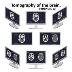 Brain Cross Section Vector Images (over 210)