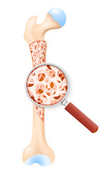 Femur Vector Images (over 4,200)