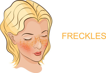 A face with freckles young women Royalty Free Vector Image