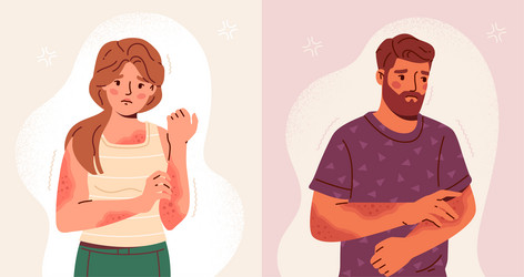 Skin problems with people character suffering Vector Image